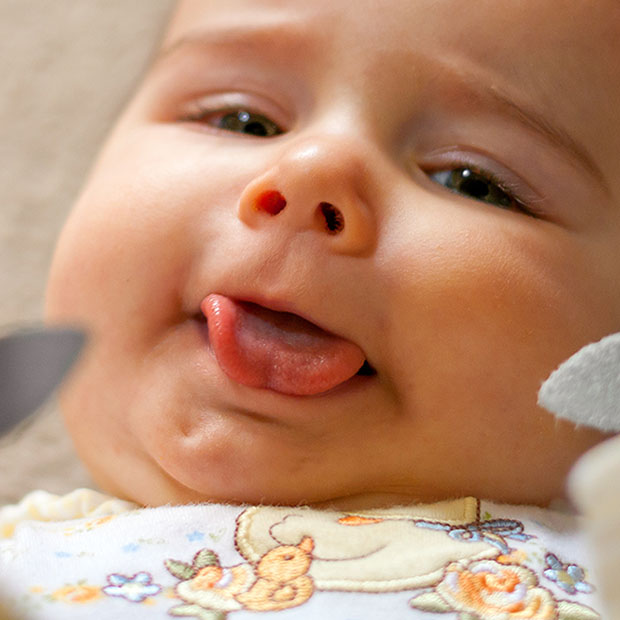 Lip and Tongue Ties: A Guide for Parents – Canton MI | Mortiere and ...